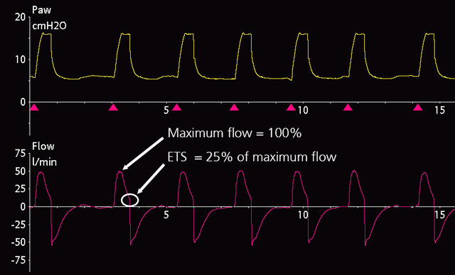 How to set expiratory trigger sensitivity (ETS) | Hamilton Medical
