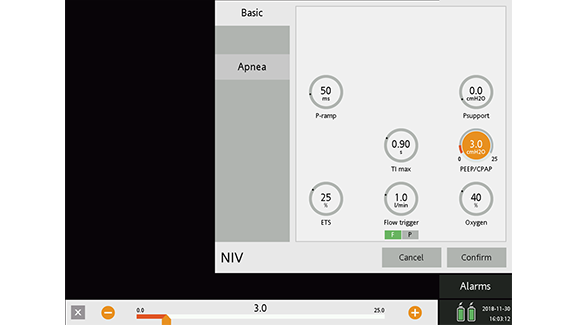 Initial settings for the most important NIV parameters in children ...