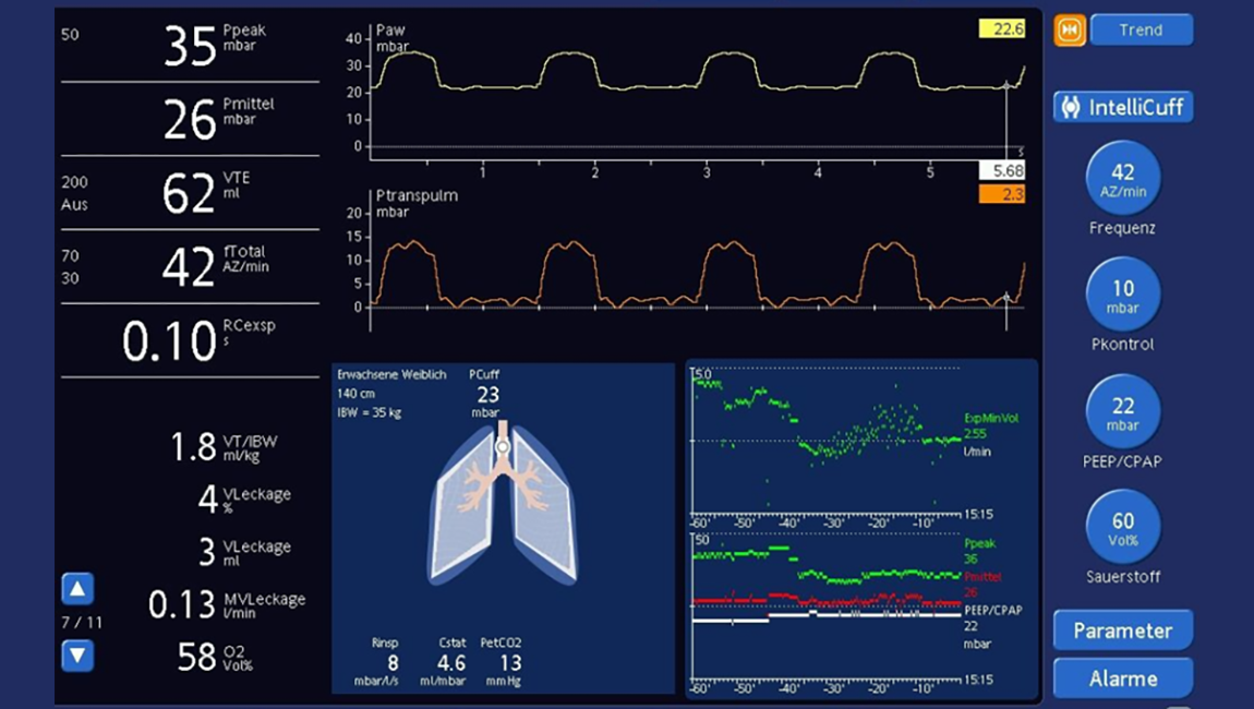 How to manage cuff pressure in children intubated with cuffed tubes ...
