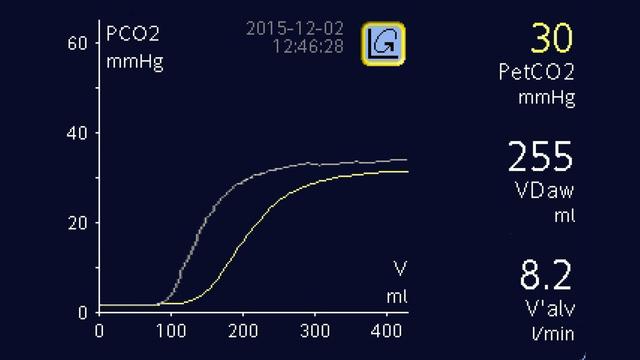 Volumetric capnography training
