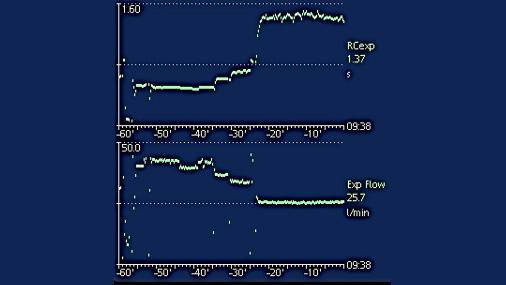 How to recognize increases in expiratory filter resistance