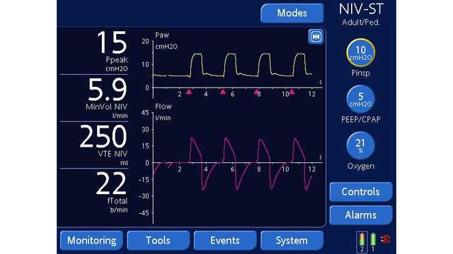 Pinsp setting in NIV-ST | Hamilton Medical