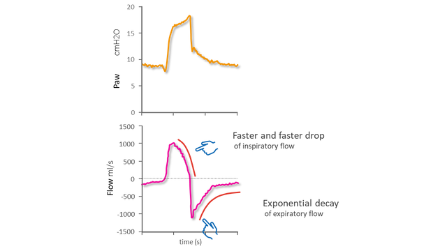 Using waveforms to indentify asynchronies - Step 1