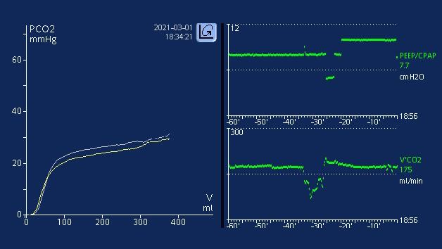 Using the Trend function for PetCO2