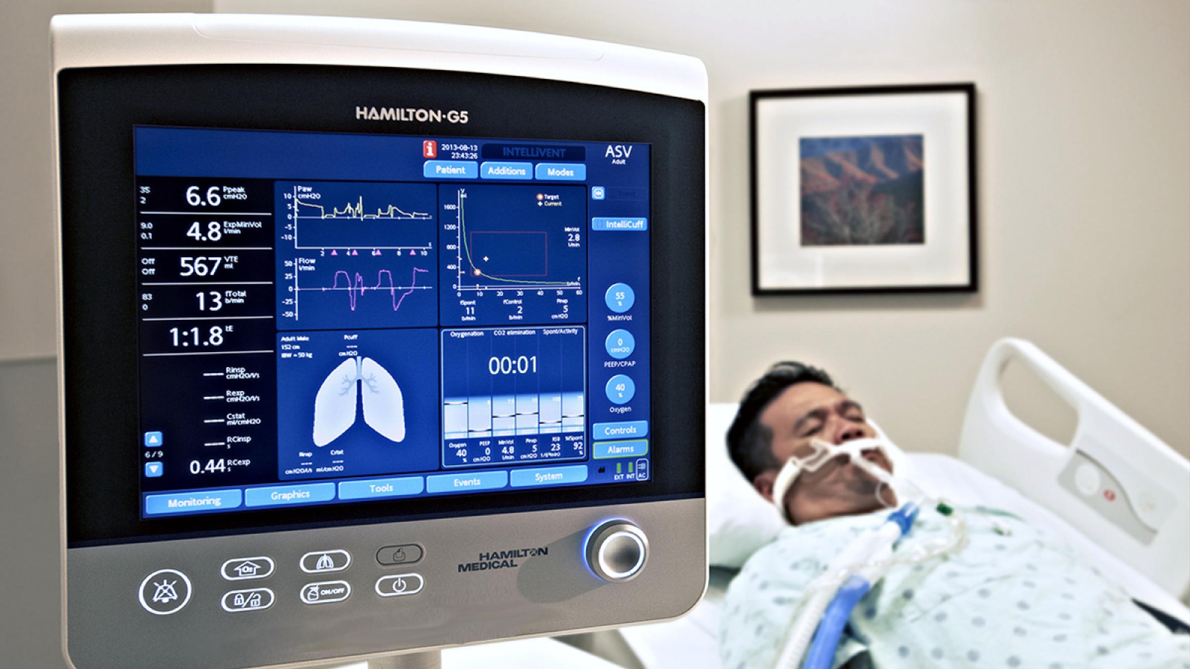 INTELLiVENT-ASV seemingly causing discomfort for waking patient ...