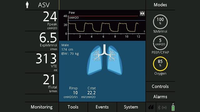 Test your IntelliVence (Vol 20 Issue 1) | Hamilton Medical