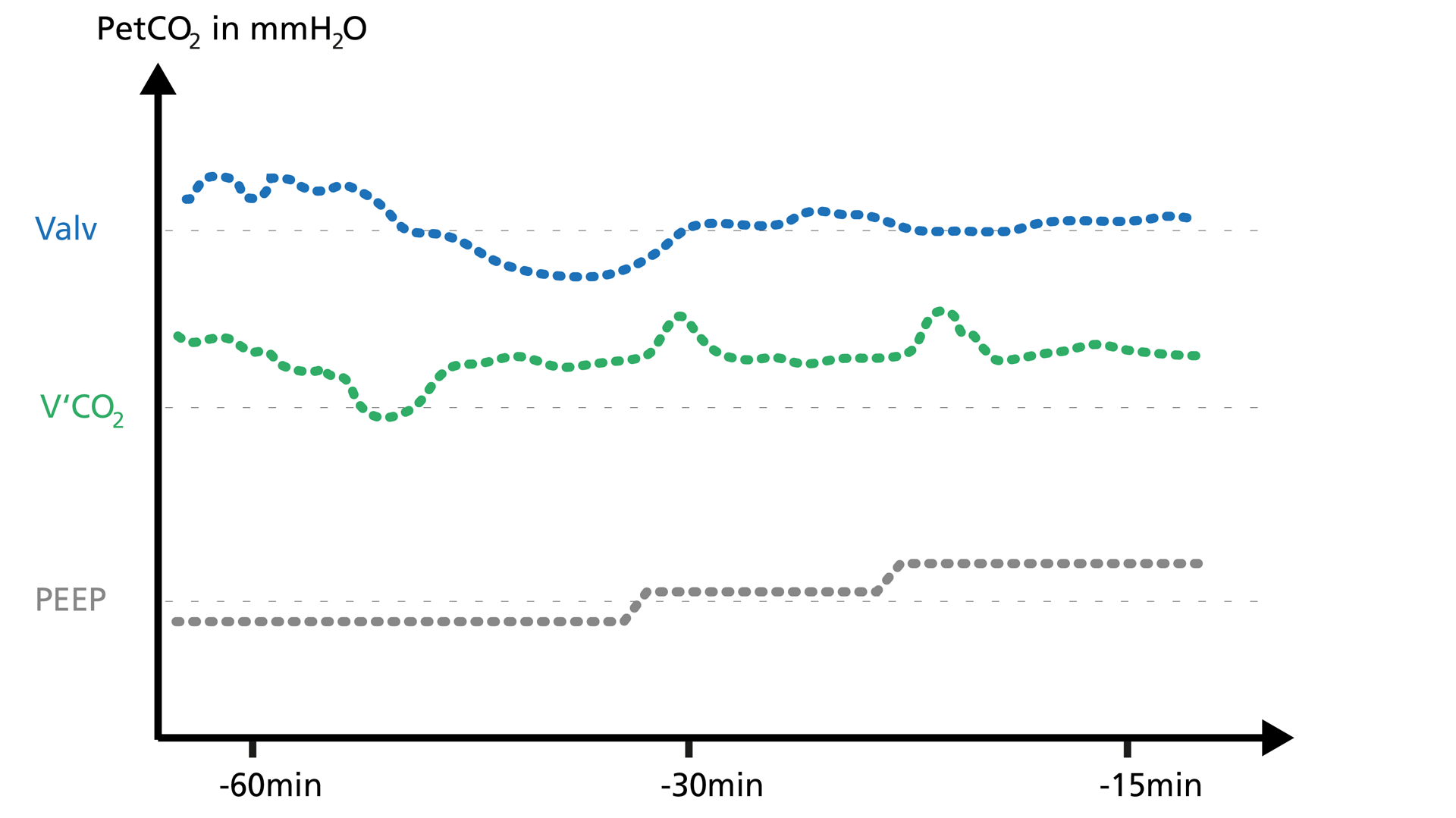 Basics of volumetric capnography - Part 4: Clinical applications of ...