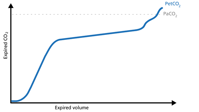 Basics of volumetric capnography - Part 3: Clinical relevance ...