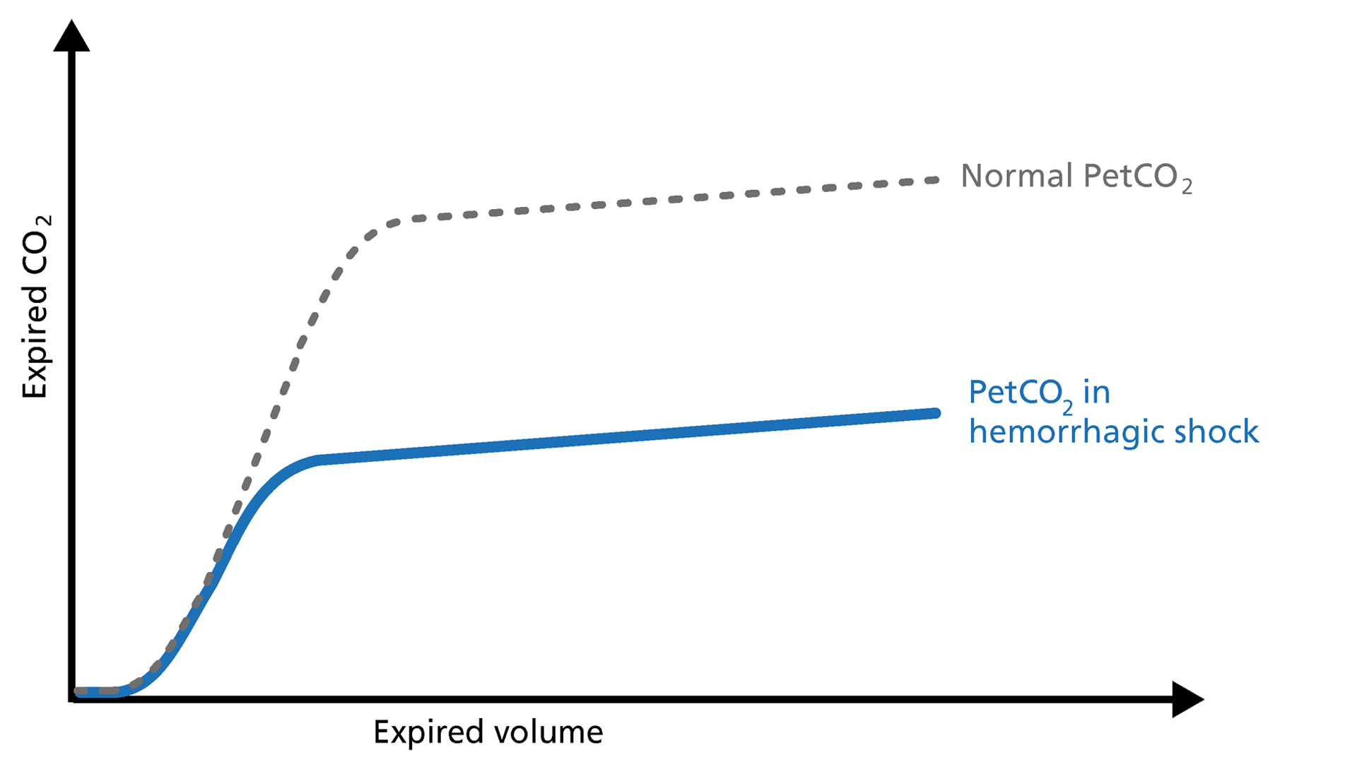 Basics of volumetric capnography - Part 3: Clinical relevance | Hamilton Medical