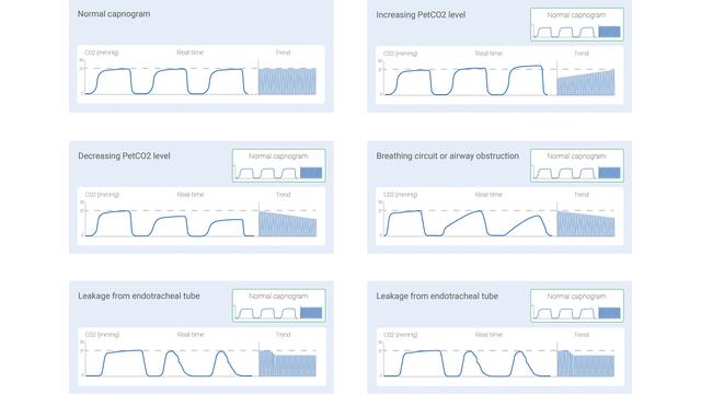 Basic waveform capnography as a continuous monitoring tool during ...