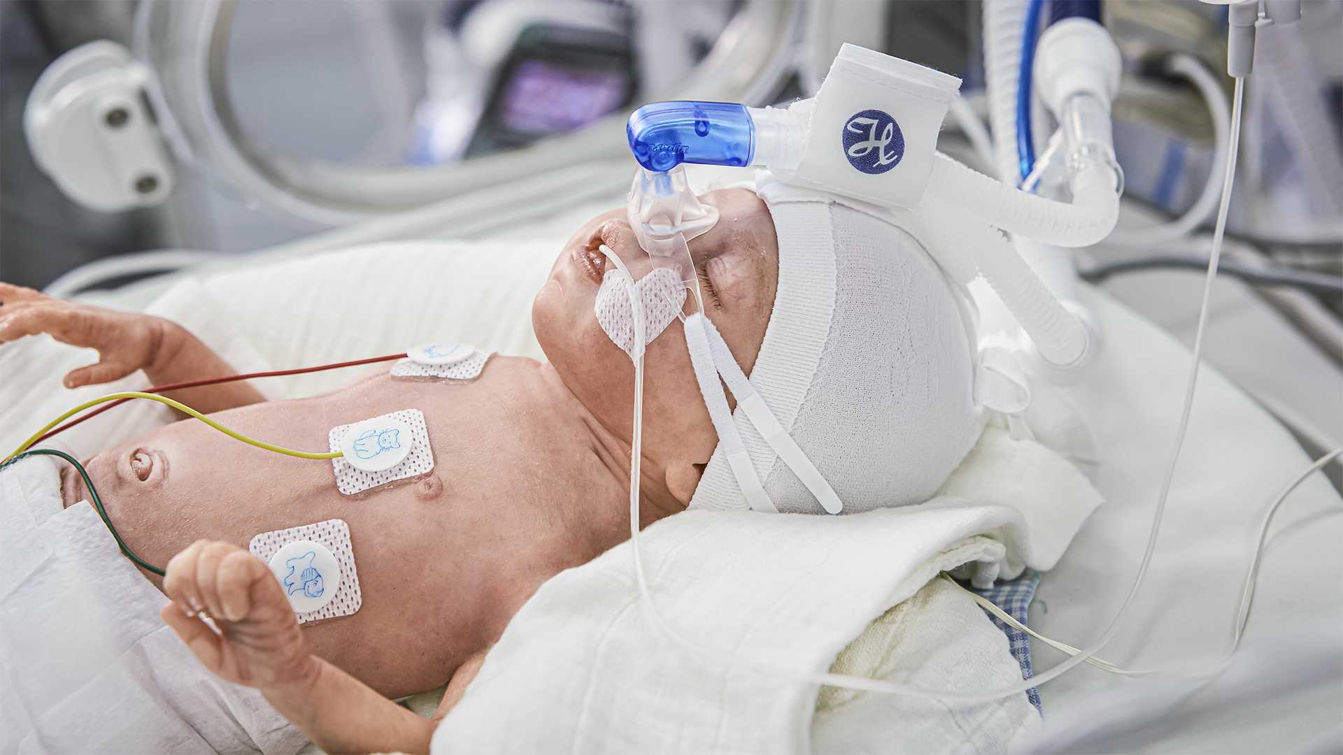 Interfaces nCPAP para respiradores mecánicos | Hamilton Medical