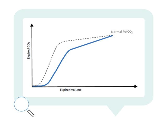 Ventilation quiz answers | Hamilton Medical