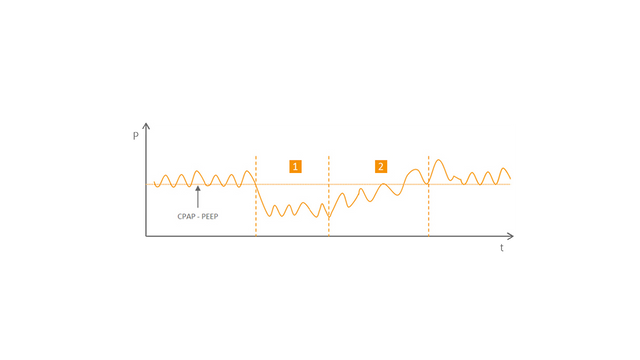 Respiratory support, nCPAP, CPAP, high flow | Hamilton Medical