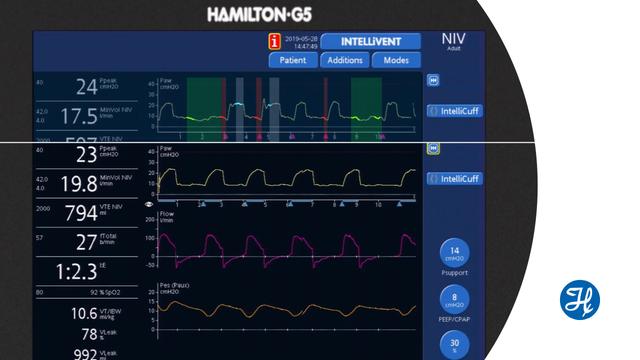 IntelliSync+ training | Hamilton Medical