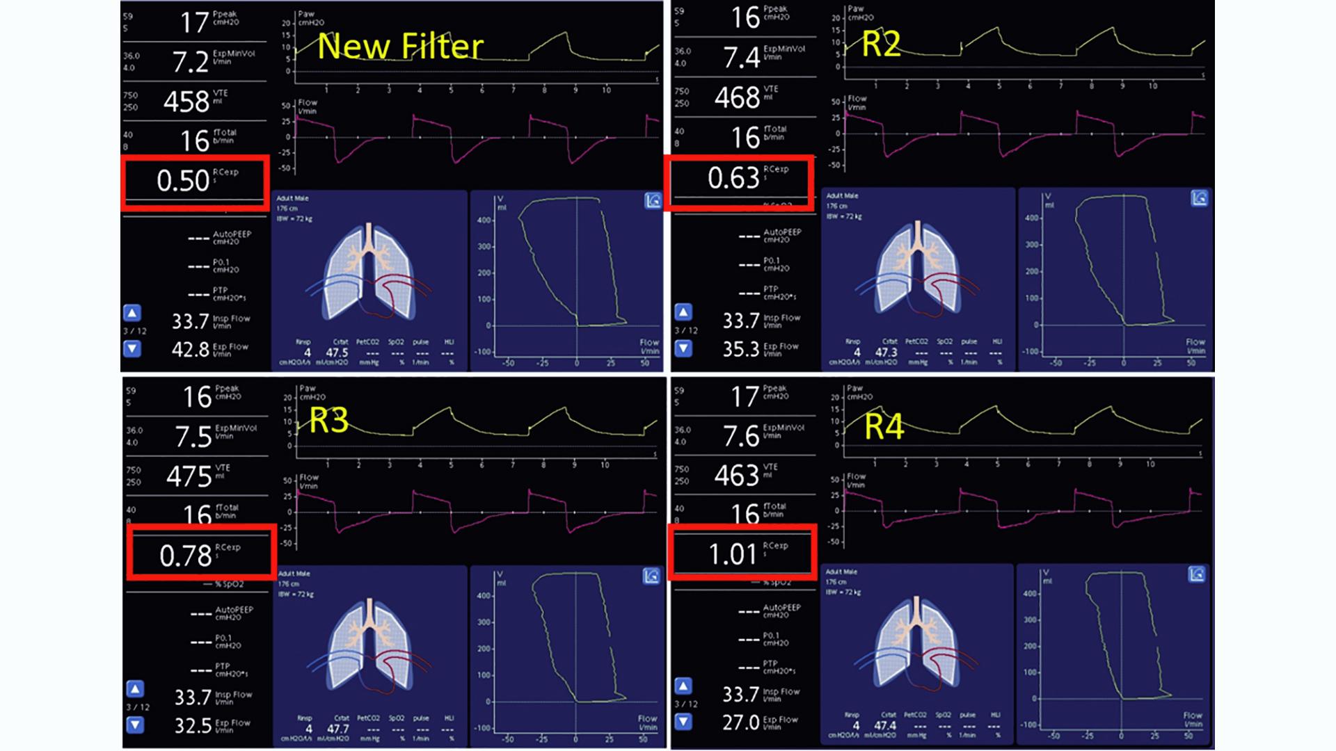 How to recognize increases in expiratory filter resistance
