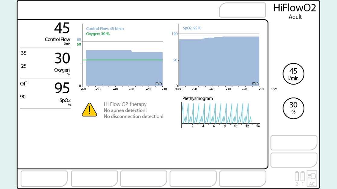 High flow nasal cannula therapy (HFNC) | Hamilton Medical