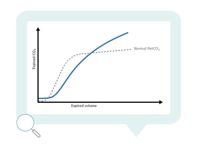 Ventilation quiz answers | Hamilton Medical