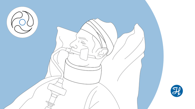 INTELLiVENT-ASV training | Hamilton Medical