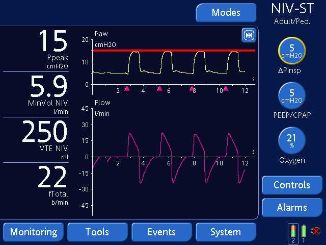 ∆Pinsp setting in NIV-ST | Hamilton Medical
