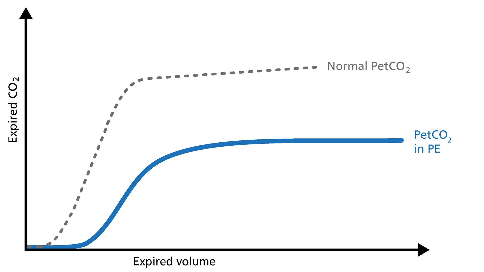 Basics of volumetric capnography - Part 3: Clinical relevance | Hamilton Medical